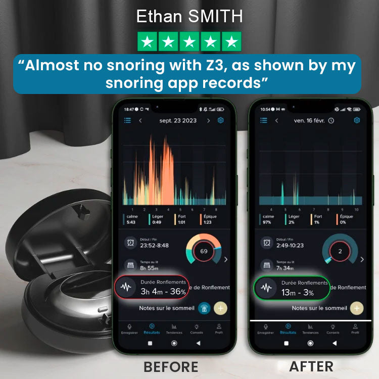 Z3 Pro™ - Professional Anti-Snoring Device – Novanord Labs